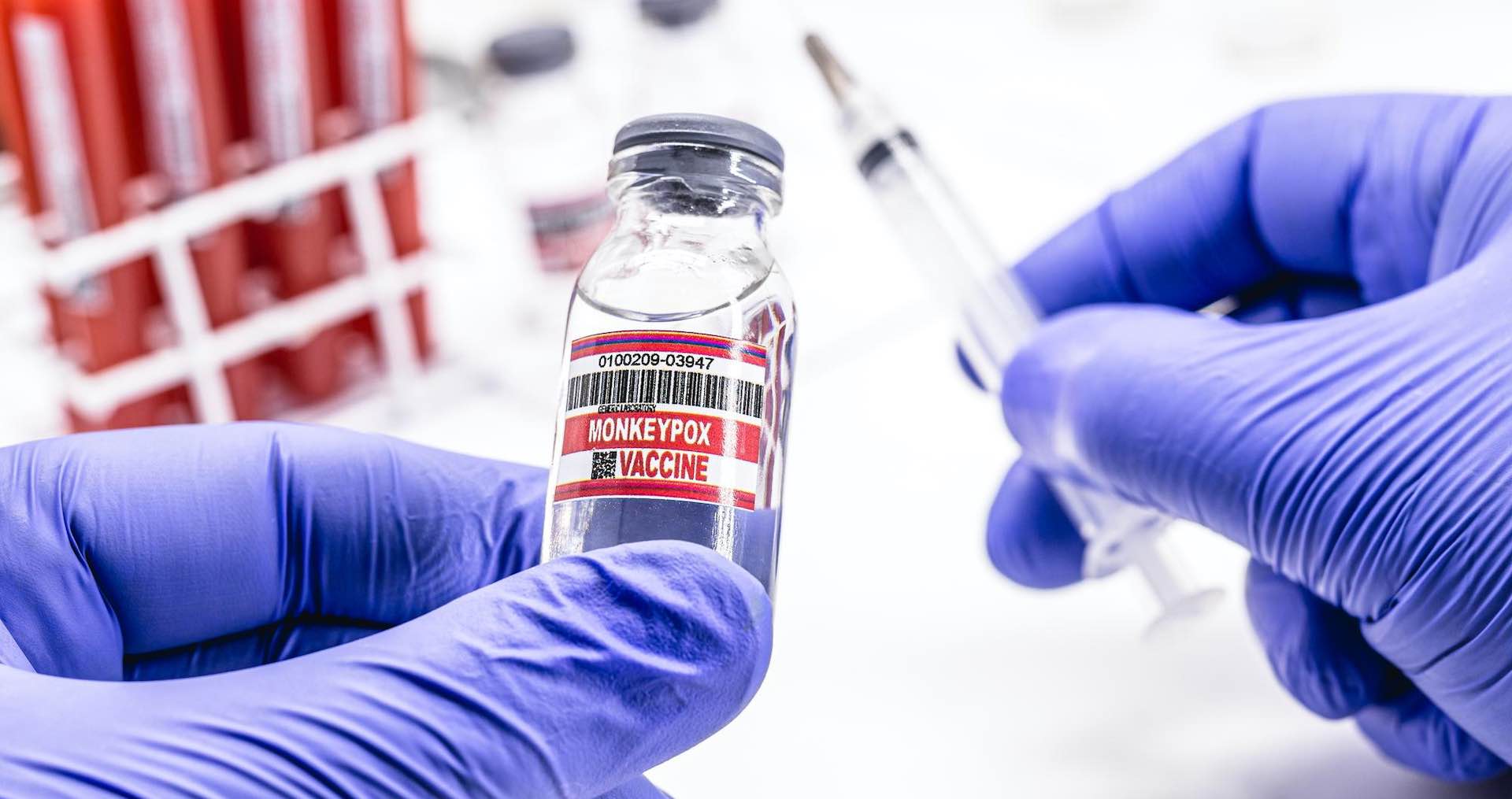 First monkeypox case has been reported in Saudi Arabia - Egyptian Era